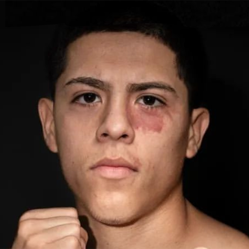 WBA Fights Schedule – World Boxing Association